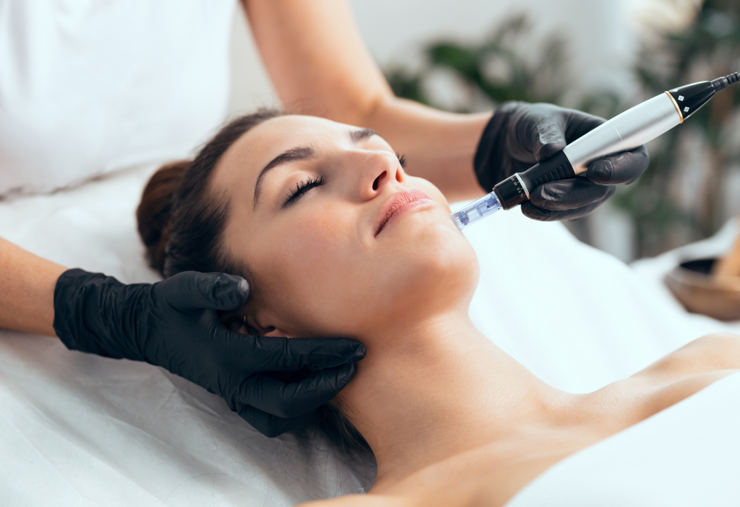 Microneedling Facial Treatments In Wesley Chapel, FL | TriHealth Medspa